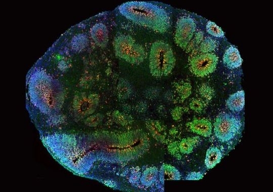 Growing Human Organs In A Lab: As Scientists Develop Pathbreaking Three ...