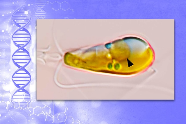 'Nitroplast': Why The Discovery Of This Organelle Is A Landmark Event ...