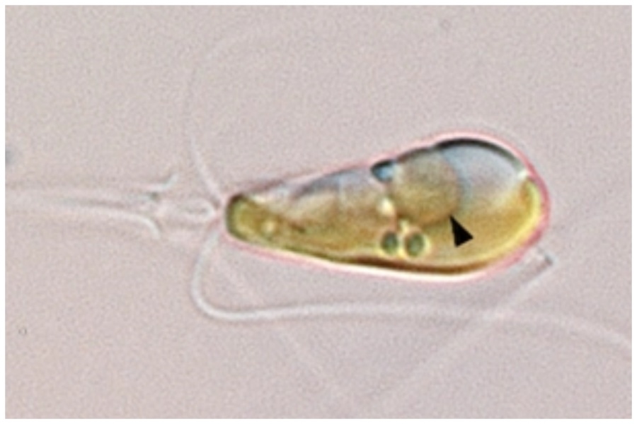 'Nitroplast': Why The Discovery Of This Organelle Is A Landmark Event ...